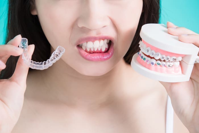 How To Get Misplaced Teeth In Shape In No Time - Abacus Dental Care ...