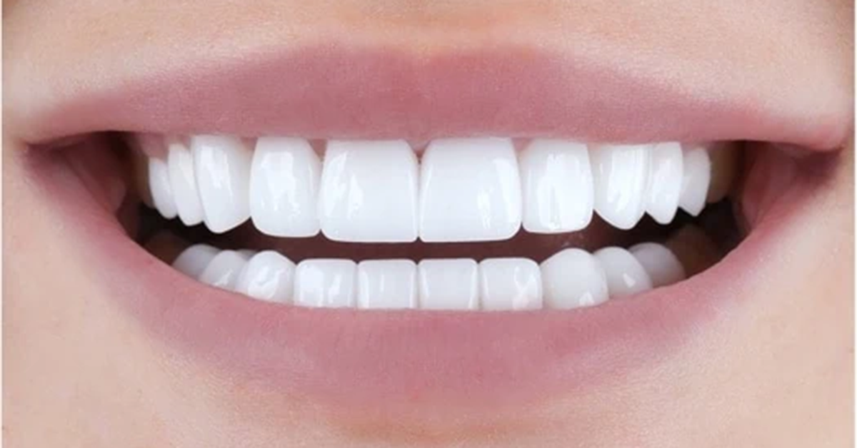 Turkey Teeth, what's the real harm? - Abacus Dental Care & Implant Clinic