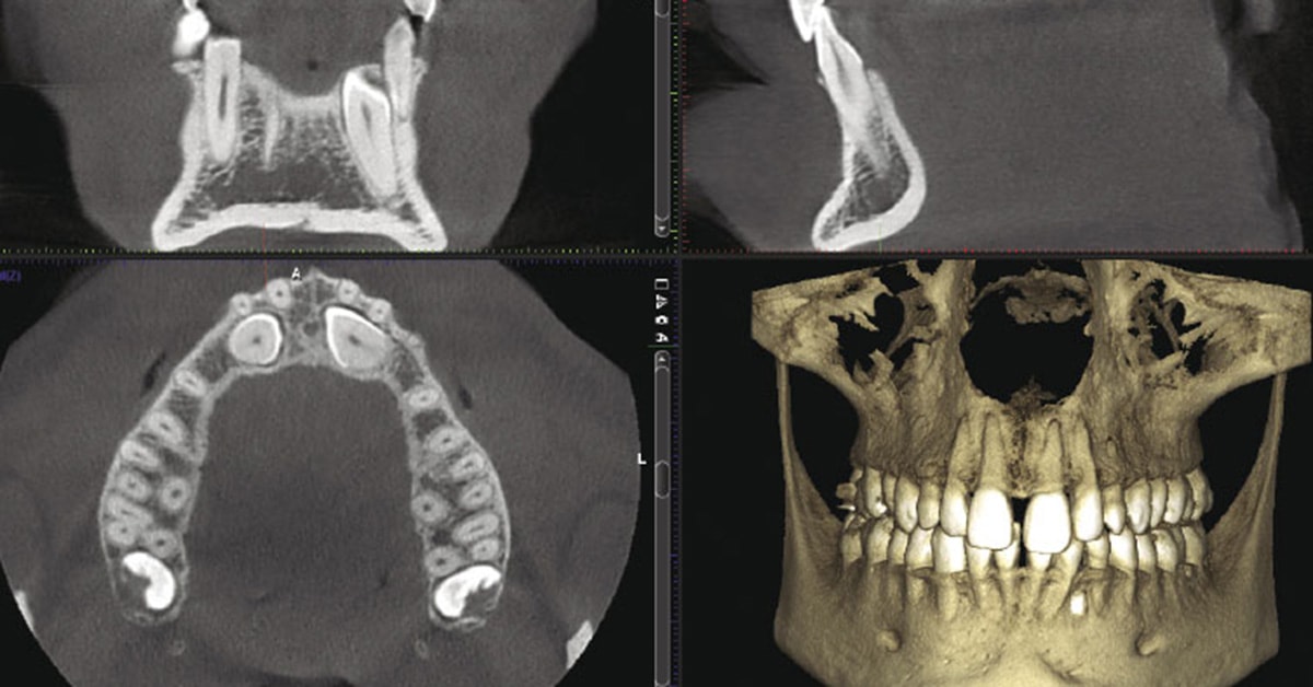 Precision Dentistry in Milton Keynes - Abacus Dental Care & Implant Clinic